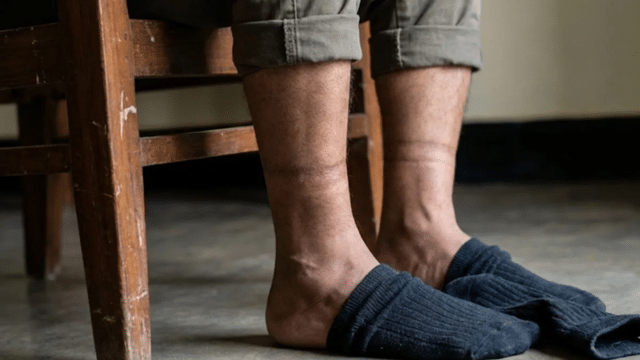 If you notice deep marks on your feet after taking off your socks, it ...